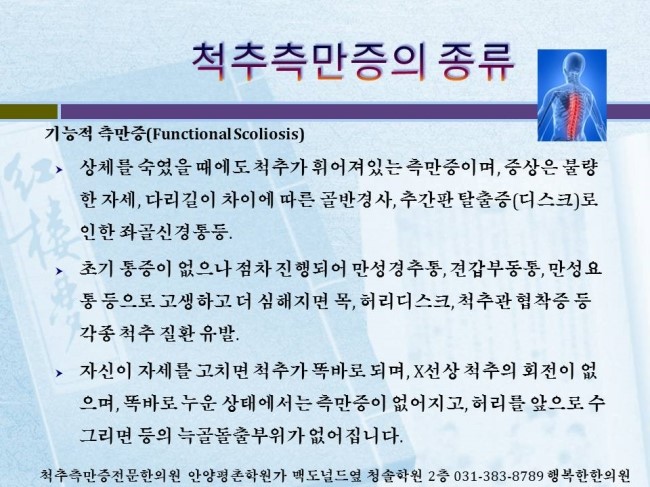 안양척추측만증전문클리닉 안양한의원 환자가 궁금해하는 척추측만증 안양척추측만증전문클리닉 안양한의원 네이버 블로그