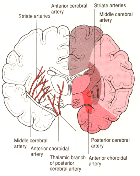 후대뇌동맥 경색posterior Cerebral Artery Territory Infarction 정상 기능 증상 예후