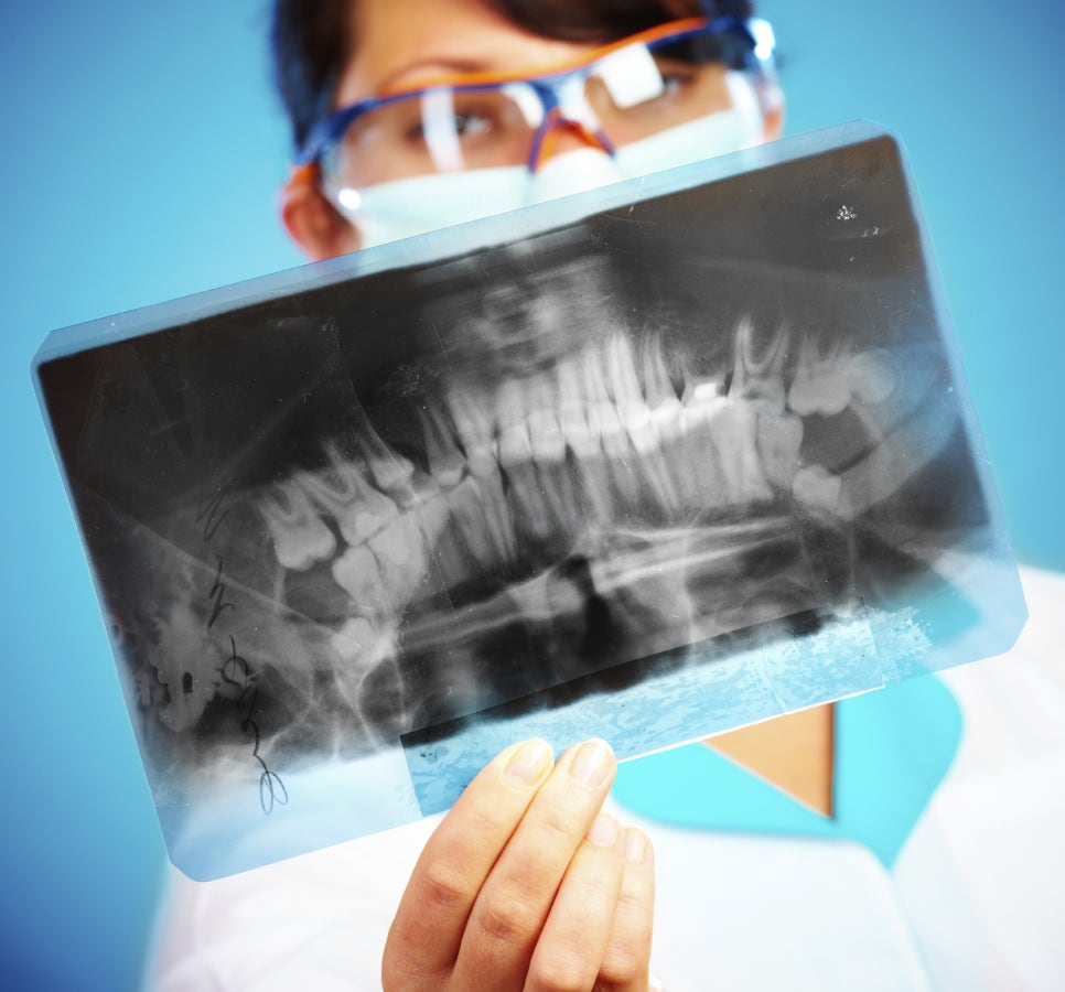 치과에서 촬영하는 엑스레이 X Ray 종류 치과 방사선 사진 파노라마 Cbct 등 By 닥터자일리톨