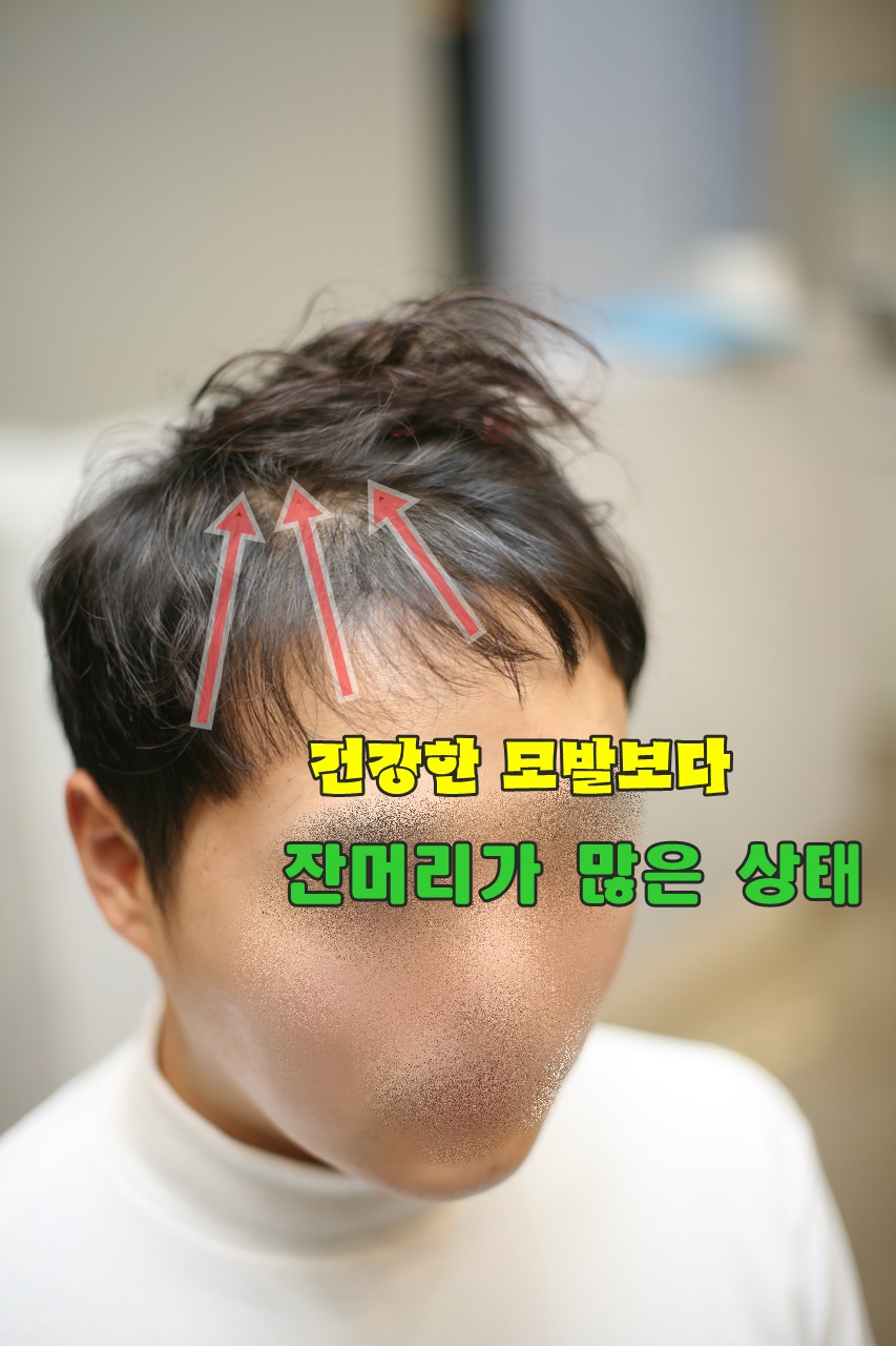 머리숱 없는 남자 펌 탈모 파마 풍성한 효과 네이버 블로그