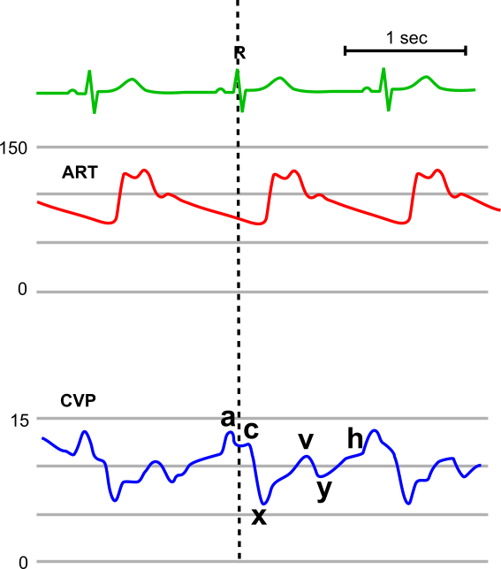 Physical assessment 2-2편 : 네이버 블로그